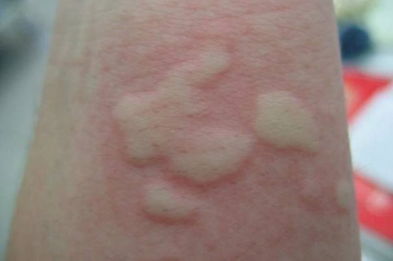 Apa itu Gegata, Punca dan Petua Menghilangkannya